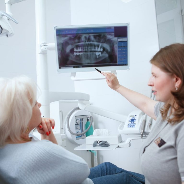 Implantes Dentários: A Importância do Protocolo de Branemark - Ponte ...